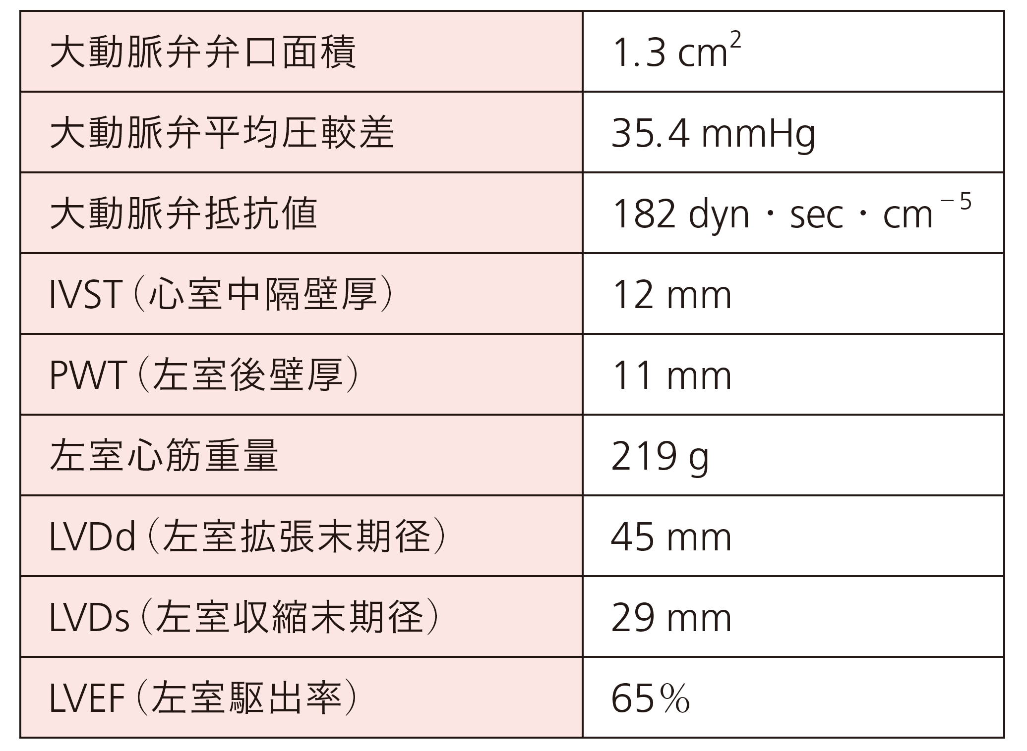 心エコー図 - 健康百科事典
